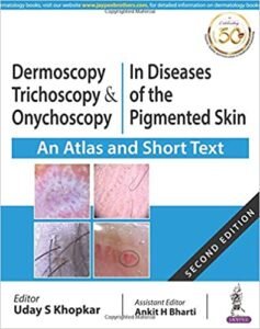 Buy Dermoscopy, Trichoscopy & Onychoscopy in Diseases of the Pigmented ...